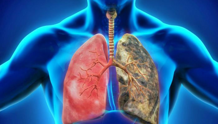 What is E.P.O.C? Excess Post-Exercise Oxygen Consumption - PT Courses ...